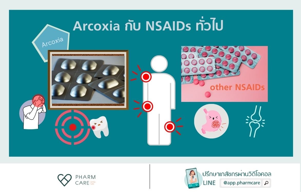 ยา Arcoxia® แตกต่างจากยาแก้ปวด หรือยา NSAIDs ทั่วไปอย่างไร