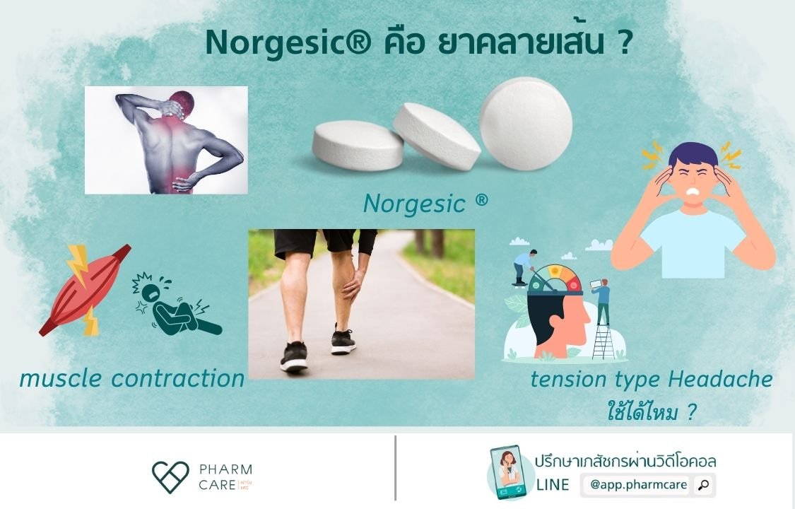 ยานอร์จีสิค(Norgesic®)คือยาคลายเส้นใช่หรือไม่ ใช้แก้ปวดศีรษะได้หรือไม่